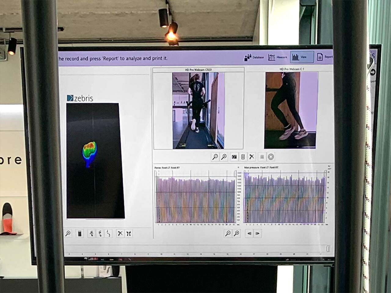 Voxelcare Motion Capture Analysis System | Transform Your Podiatric Practice